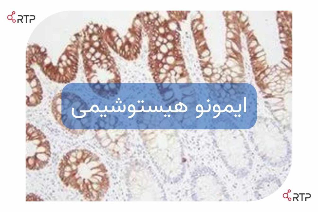 15 روش برای IHC بهتر - رادمان تشخیص پارس